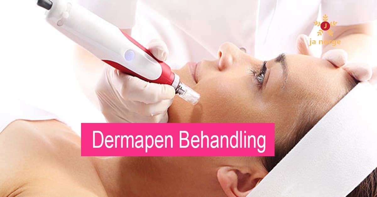 Dermapen Behandling: Pris og Tilgjengelighet i Oslo, Trondheim, Bergen ...