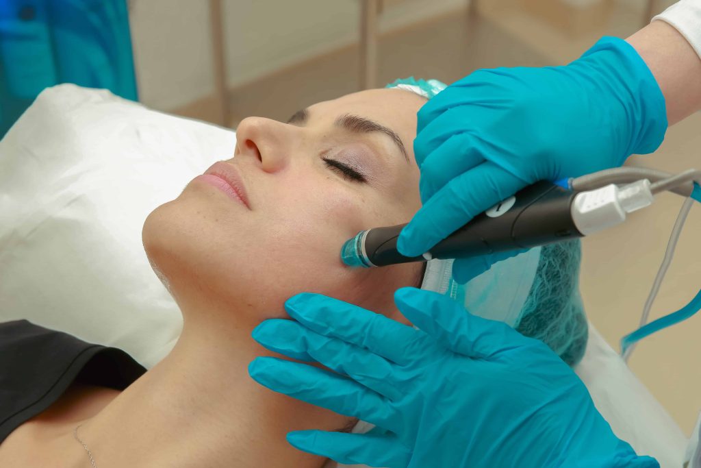 Dermapen Behandling: Pris og Tilgjengelighet i Oslo, Trondheim, Bergen ...